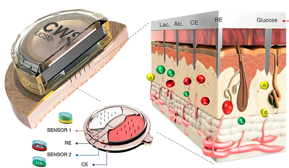 Wearable Microneedle Sensor | nextgenterc